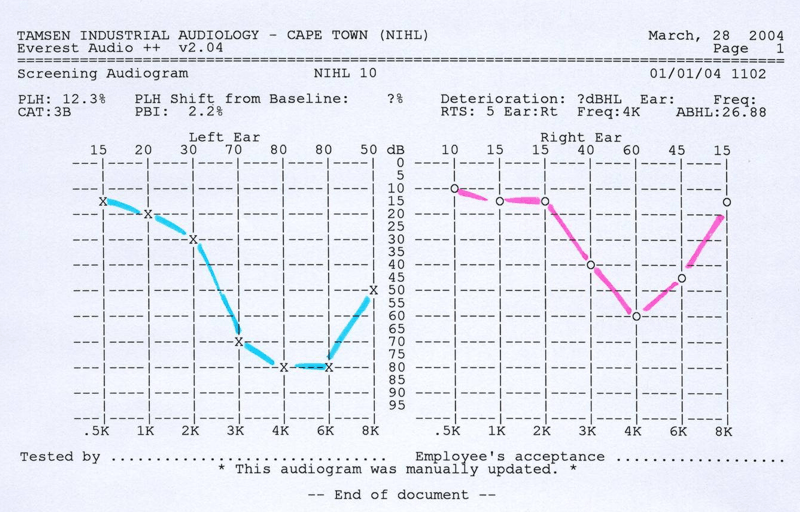 Index of audiograms